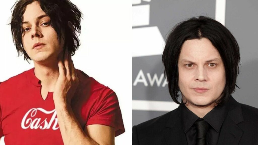 Jack White’s Plastic Surgery: What Procedure Has He Undergone?