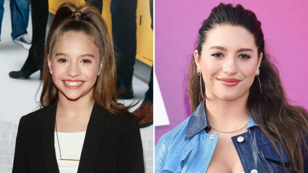 Kenzie Ziegler’s Nose Job: Here’s Why the Singer Got a Rhinoplasty at 18!