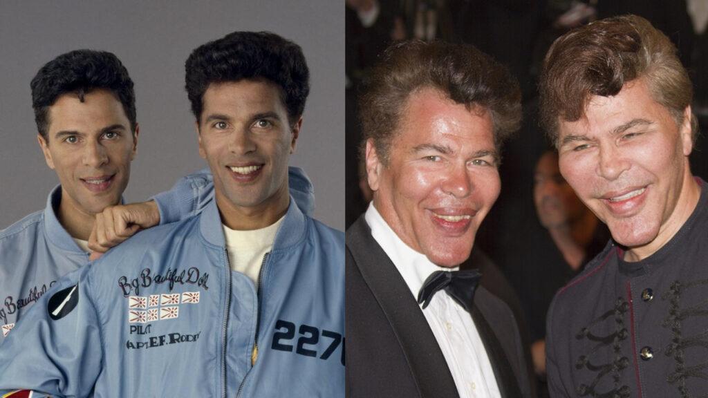 How Did Igor and Grichka Bogdanoff Look Before Plastic Surgery?