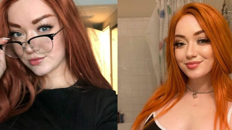 Emma Magnolia’s Plastic Surgery: Did She Go For Botox and Lip Fillers?