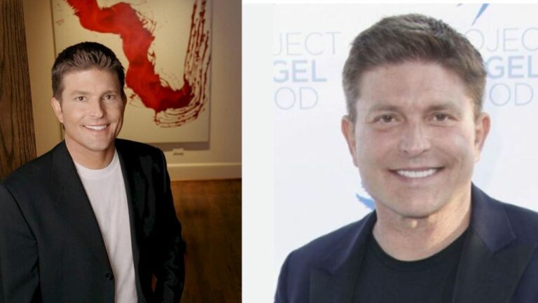 Kenny Goss’s Plastic Surgery Has Prevented Him From Aging